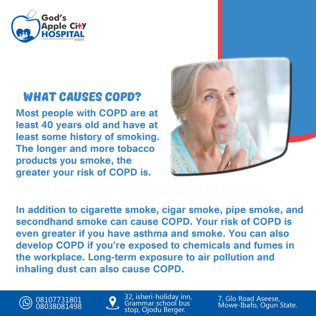 Chronic obstructive pulmonary disease – God's Apple City Hospital