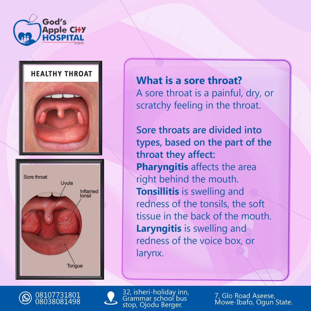 Sore Throat – God's Apple City Hospital