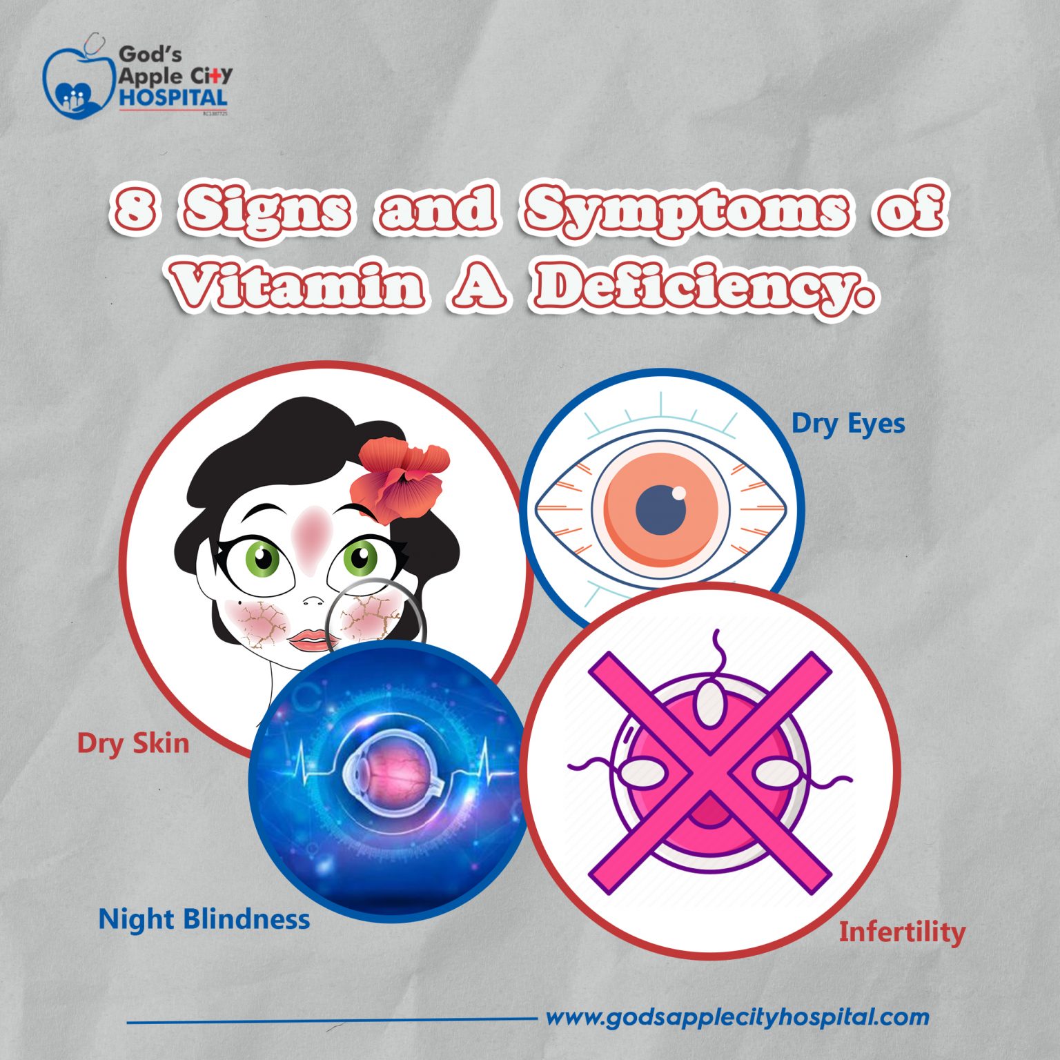 8 Signs and Symptoms of Vitamin A Deficiency – God's Apple City Hospital