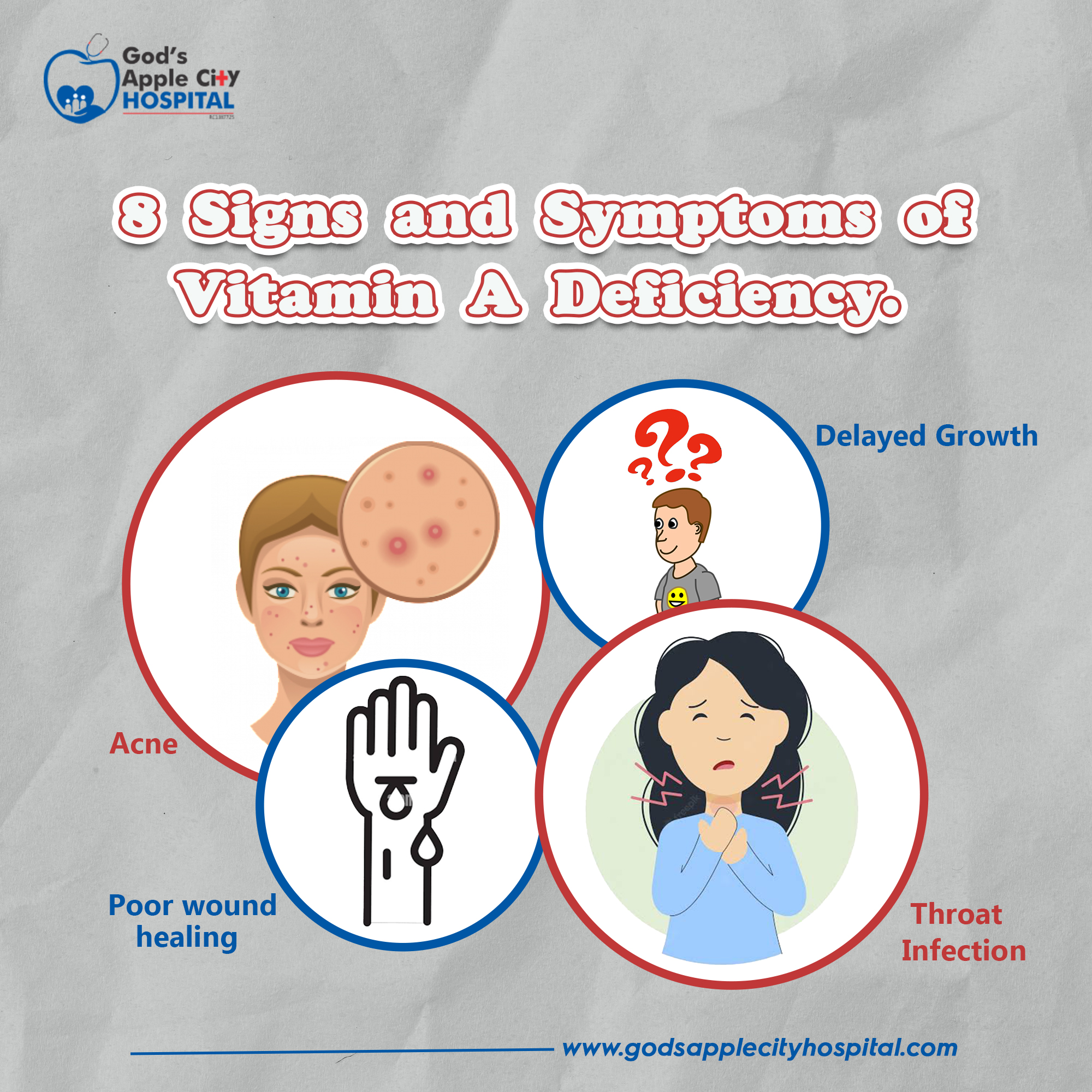 8 Signs and Symptoms of Vitamin A Deficiency – God's Apple City Hospital